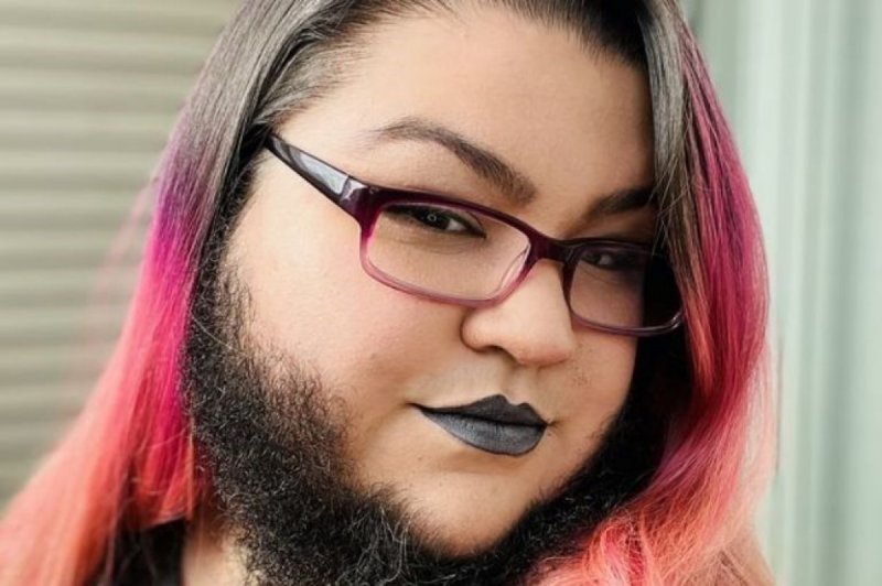 Mujer con barba deja de afeitarse por un año; “me siento hermosa”, dice